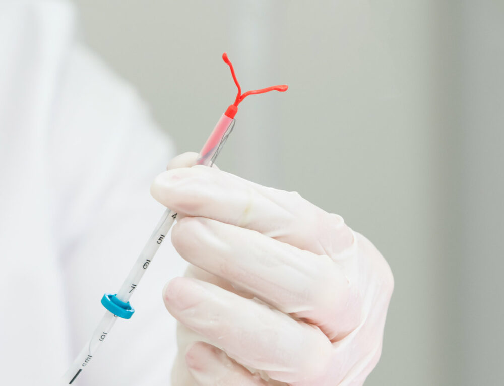 DIU saiu do lugar? Como o ultrassom confirma a posição correta